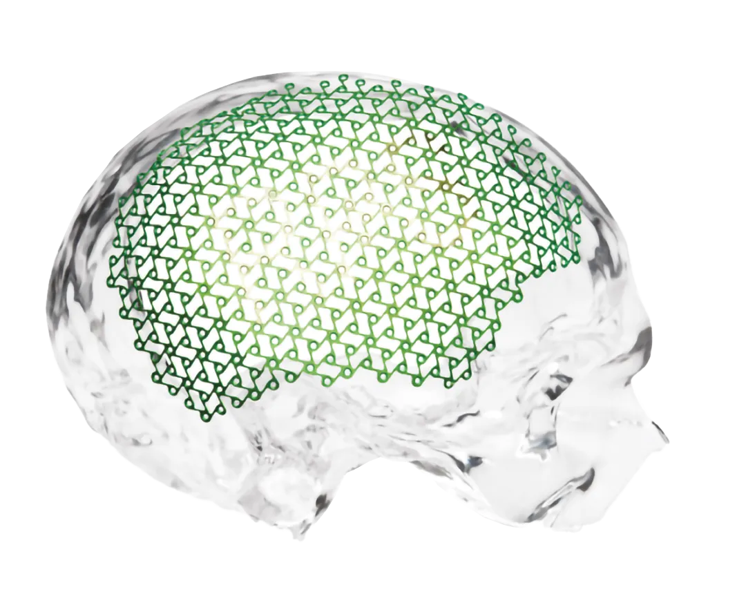 Craneoplastía - Soluciones en titanio para defectos craneales